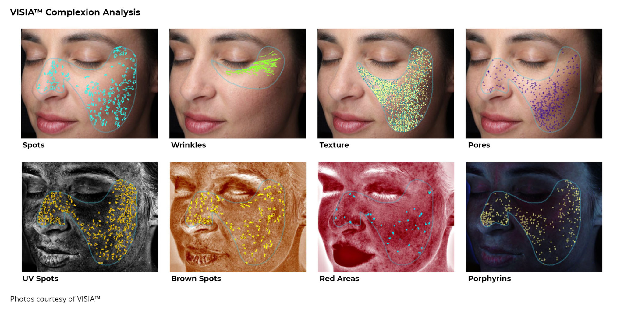 Skin Analysis with VISIA - IHASA